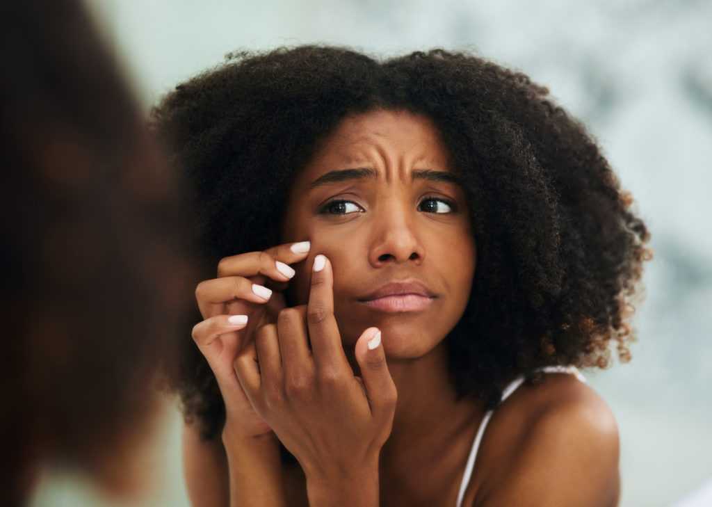How to Remove Skin Blemishes Without Bleaching – Svelte Magazine