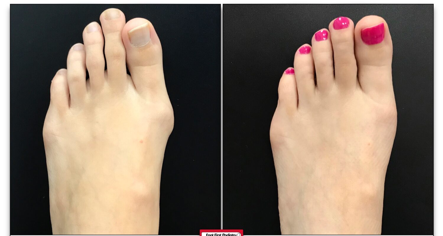 Ugly Feet: 6 Easy Ways to Beautify & Transform Them